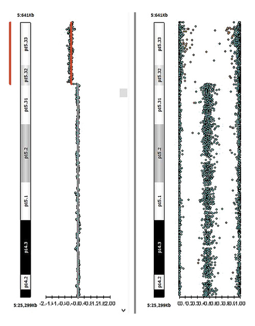 Cri-du-Chat Syndrome: Revealing a Familial Atypical Deletion in 5p ...