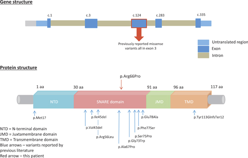 VAMP2 Gene-Related Neurodevelopmental Disorder: A Differential ...