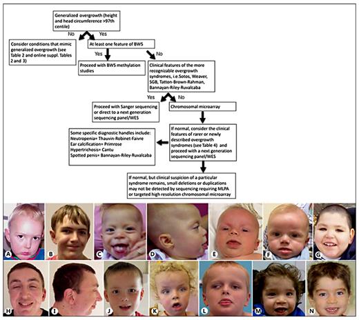 A Clinical Review of Generalized Overgrowth Syndromes in the Era of ...
