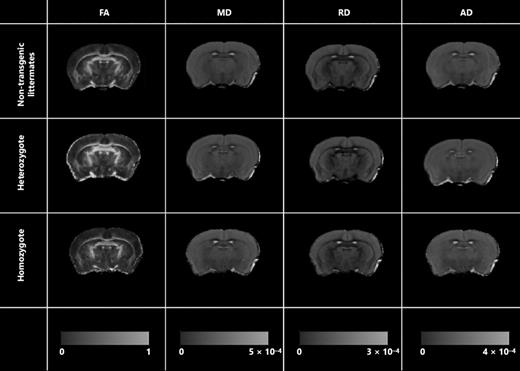Diffusion Tensor Imaging Reveals Whole-Brain Microstructural Changes in ...