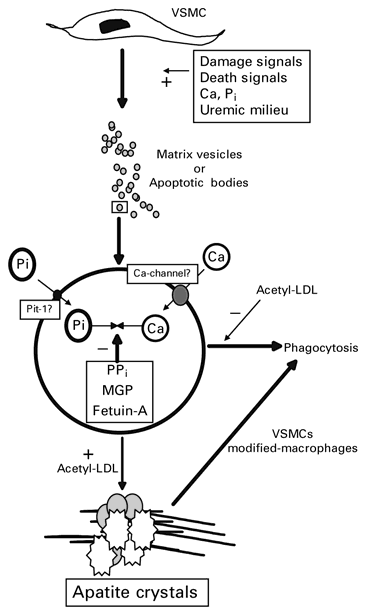 Biology of Vascular Calcification in Renal Disease | Nephron ...