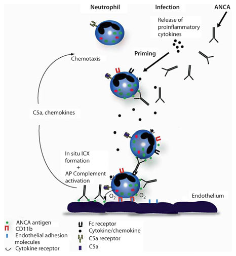 Mechanisms of Vasculitis: How Pauci-Immune Is ANCA-Associated Renal ...