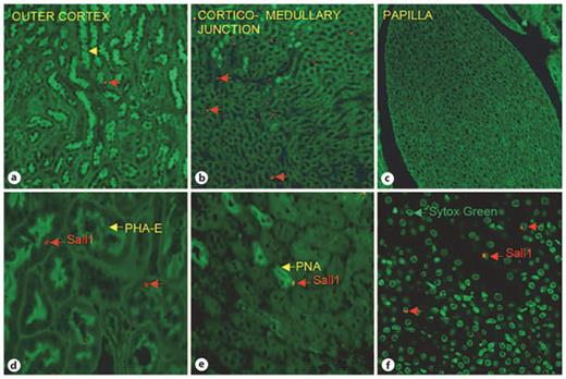 Identification and Characterization of Sall1-Expressing Cells Present ...
