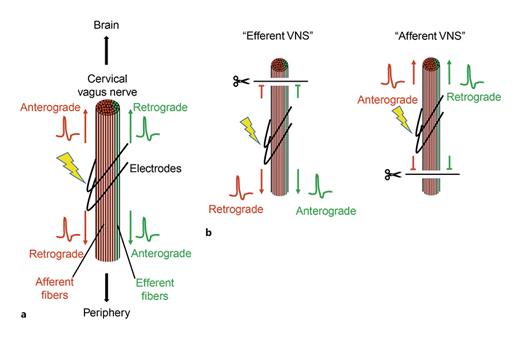 Neuroimmune Circuits Activated by Vagus Nerve Stimulation | Nephron | Karger Publishers