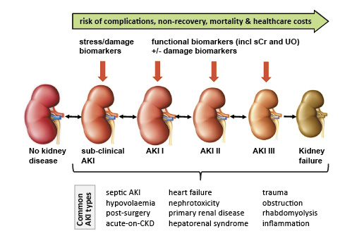 Biomarker-Based Management of AKI: Fact or Fantasy? | Nephron | Karger ...