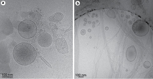Extracellular Vesicles in Acute Kidney Injury | Nephron | Karger Publishers