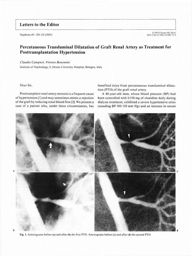 Percutaneous Transluminal Dilatation of Graft Renal Artery as Treatment ...