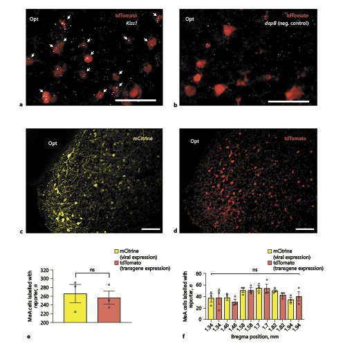 Medial Amygdala Kiss1 Neurons Mediate Female Pheromone Stimulation of ...