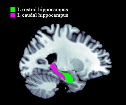 Hippocampal Dynamic Functional Connectivity, HPA Axis Activity, and ...