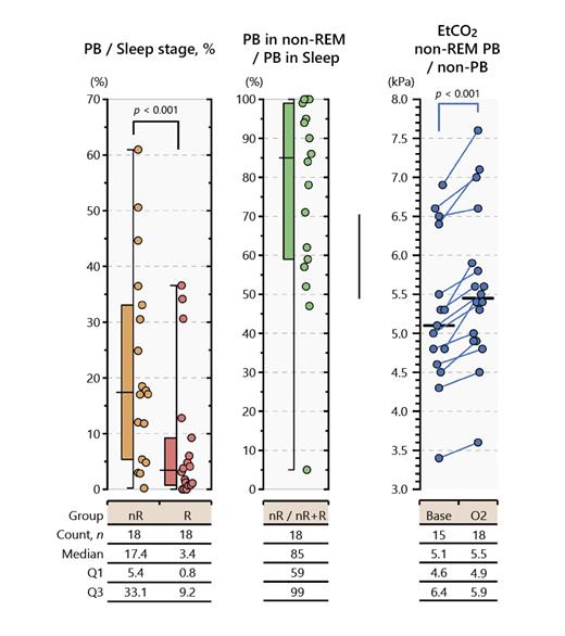 Supplemental Oxygen Treats Periodic Breathing without Effects on Sleep ...