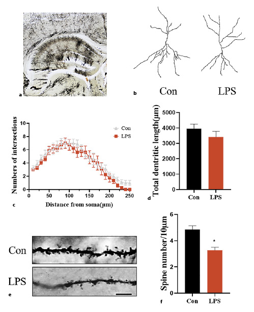 Integrated Proteomic and Phosphoproteomic Analysis of the Hippocampus ...