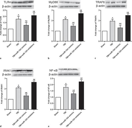 MiR-124 Reduced Neuroinflammation after Traumatic Brain Injury by ...