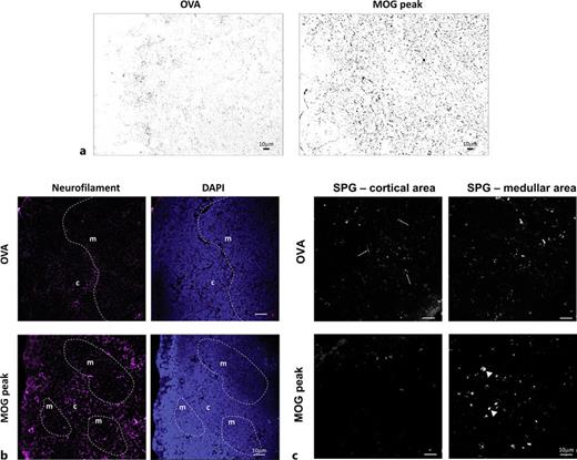 Thymic Innervation Impairment in Experimental Autoimmune ...