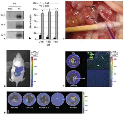 Adeno-Associated Virus-Mediated Gene Transfer to Renal Tubule Cells via ...