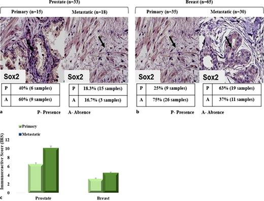 Overexpression of SOX2 Gene by Histone Modifications: SOX2 Enhances ...