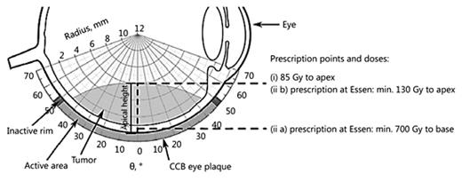 Dose Distributions and Treatment Margins in Ocular Brachytherapy with ...