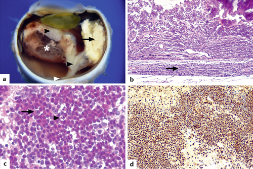 The 5th Edition of the World Health Organization Classification of ...
