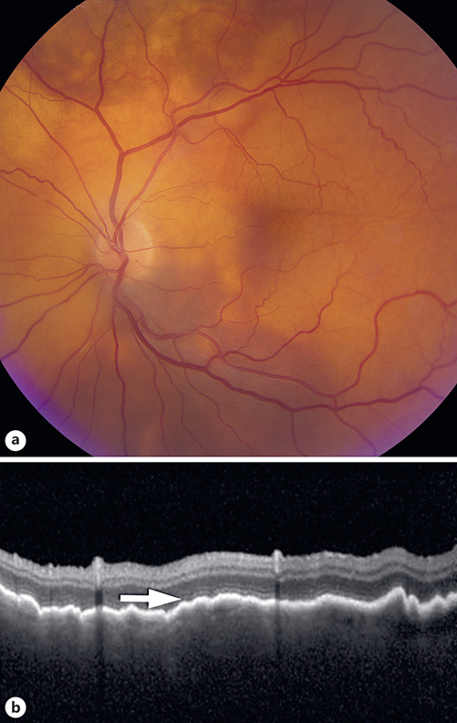 The 5th Edition of the World Health Organization Classification of ...