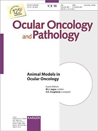 Uveal Melanoma Metastasis Models | Ocular Oncology and Pathology ...