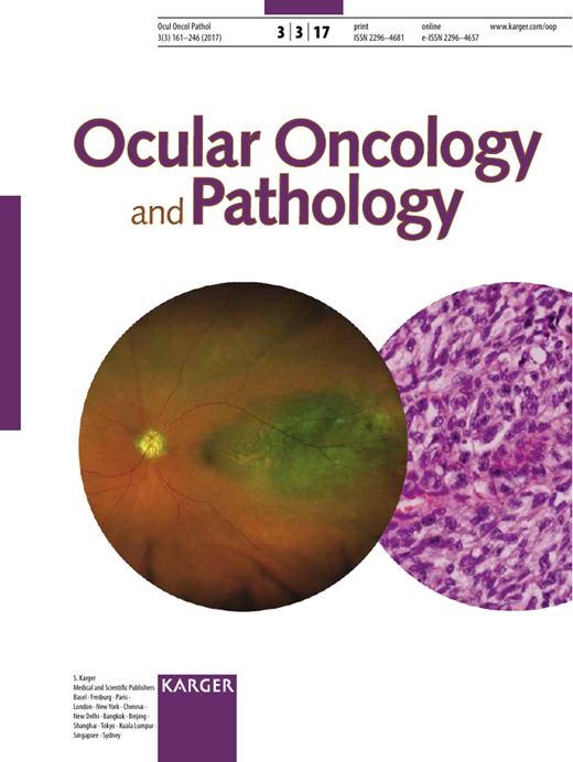 Pigmented Spindle Cell Nevus of Reed of the Eyelid | Ocular Oncology ...