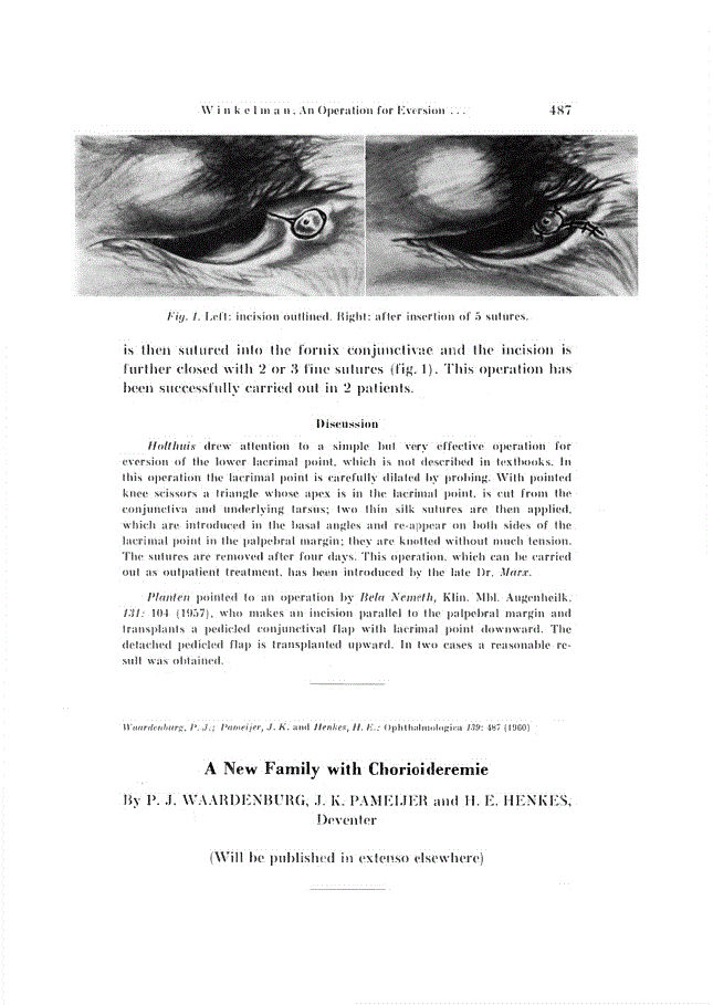 A New Family with Chorioideremie | Ophthalmologica | Karger Publishers
