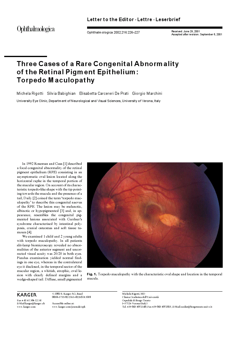 Three Cases of a Rare Congenital Abnormality of the Retinal Pigment Epithelium: Torpedo ...