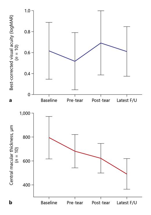 Retinal Pigment Epithelium Tears after Anti-Vascular Endothelial Growth ...