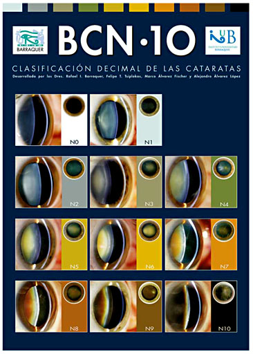 Validation of the Nuclear Cataract Grading System BCN 10 | Ophthalmic Research | Karger Publishers