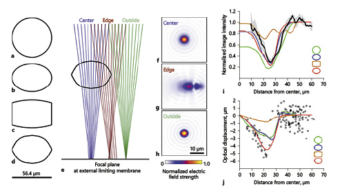 Life Cycle and Lensing of a Macular Microcyst | Ophthalmic Research ...