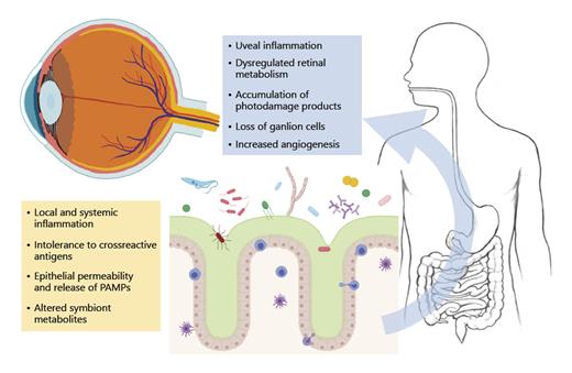 Gut Microbes and Eye Disease | Ophthalmic Research | Karger Publishers