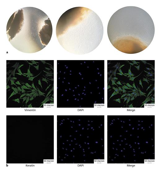 Effect of Interleukin 6 on Scleral Fibroblast Proliferation ...