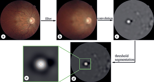 Application of Artificial Intelligence to Quantitative Assessment of ...