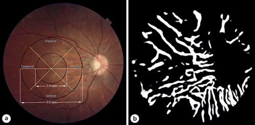 Application of Artificial Intelligence to Quantitative Assessment of ...