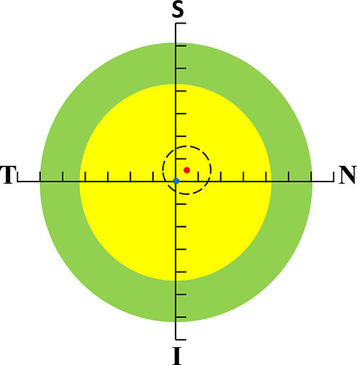 Methods of Corneal Vertex Centration and Evaluation of Effective ...
