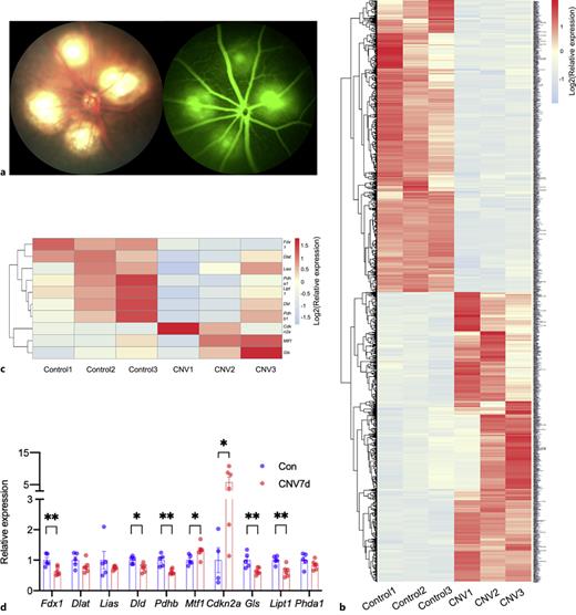 Identification of Cuproptosis-Related circRNA-miRNA-mRNA Network in ...