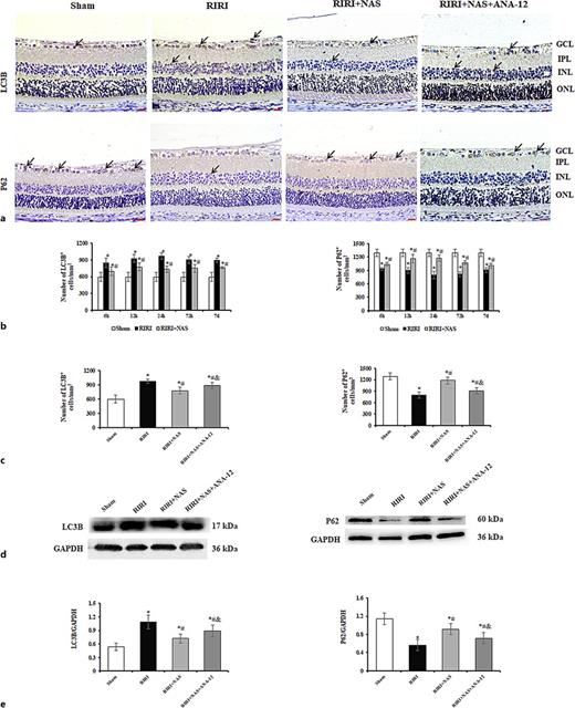 N-Acetylserotonin Alleviates Retinal Autophagy via TrkB/AKT/Nrf2 ...