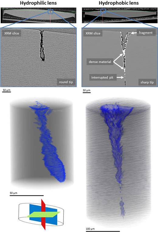 A Novel 3D High Resolution Imaging Method Using Correlative X-Ray and ...