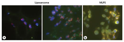 Established and Experimental Systemic Treatment Options for Advanced ...