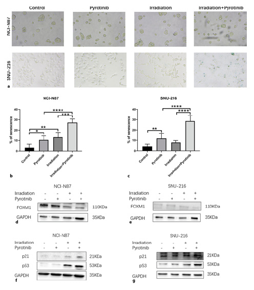 Pan-HER Tyrosine Kinase Inhibitor Pyrotinib Enhances Radiosensitivity ...