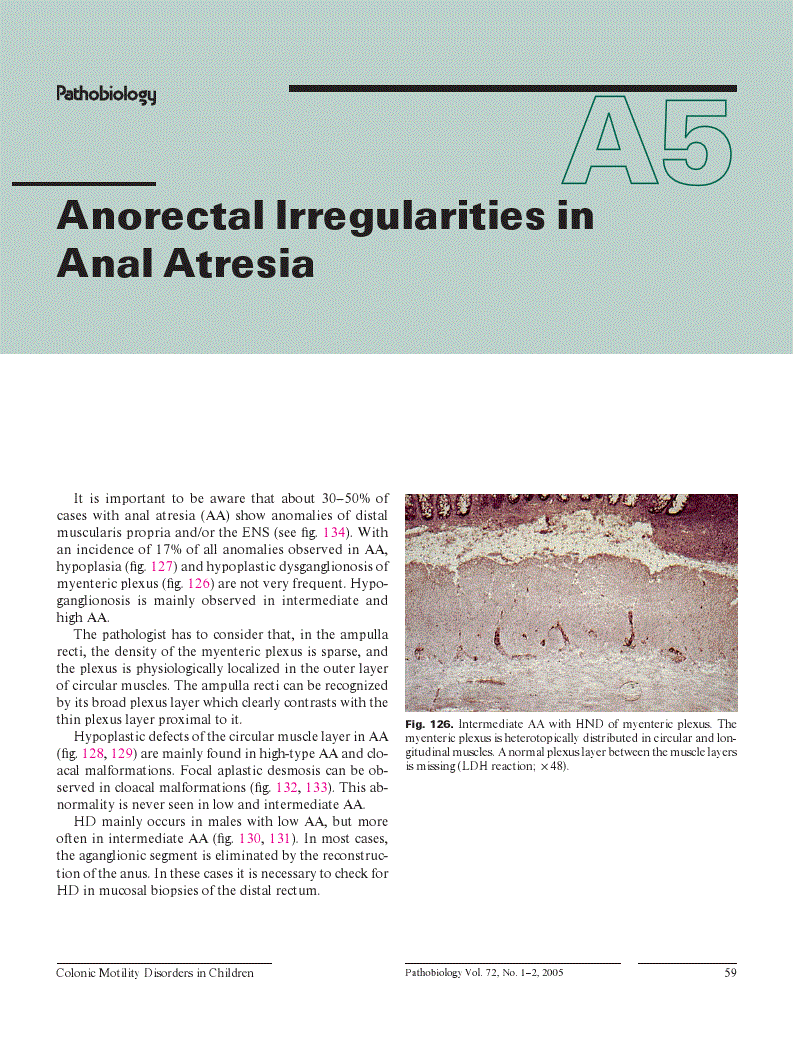 Anorectal Irregularities in Anal Atresia | Pathobiology | Karger Publishers