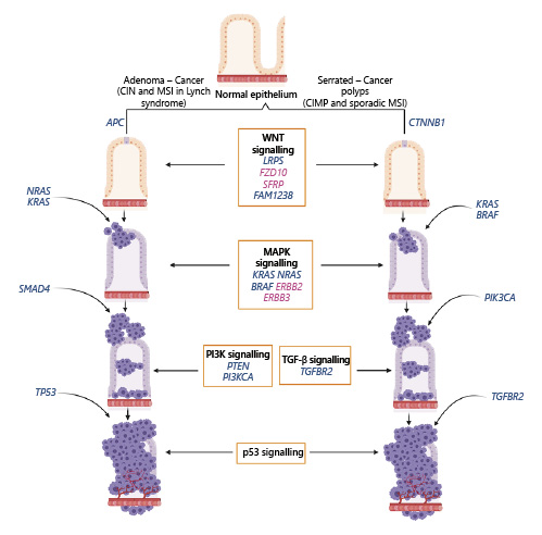 The Role of Fusobacterium nucleatum in Colorectal Carcinogenesis ...