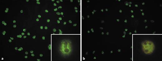 Elevated Myeloperoxidase-DNA Complex Levels in Sera of Patients with ...