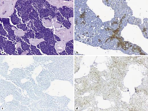 Quality Issues in Diagnostic Immunohistochemistry in Breast Pathology ...