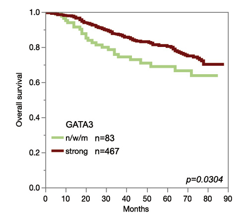 GATA3 Expression in Human Tumors: A Tissue Microarray Study on 16,557 ...