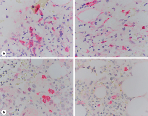 NPM1-Mutated Acute Myeloid Leukemia: Recent Developments and Open ...