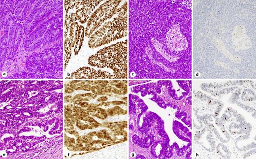 The Pathology according to p53 Pathway | Pathobiology | Karger Publishers
