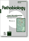 Laser Microdissection and Microsatellite Analyses of Breast Cancer ...