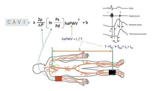 Expert Consensus on the Clinical Use of Pulse Wave Velocity in Asia | Pulse | Karger Publishers