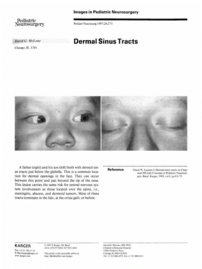 Dermal Sinus Tracts | Pediatric Neurosurgery | Karger Publishers