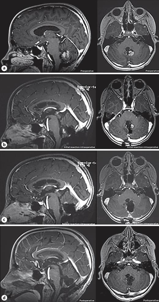Advances in Imaging Modalities for Pediatric Brain and Spinal Cord ...